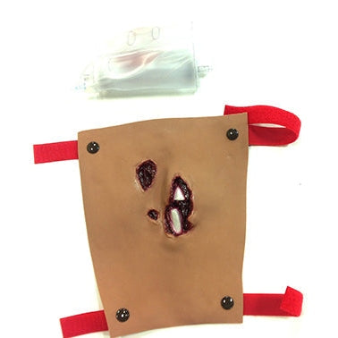 Tibia /Compound Fracture African-American – MedTech